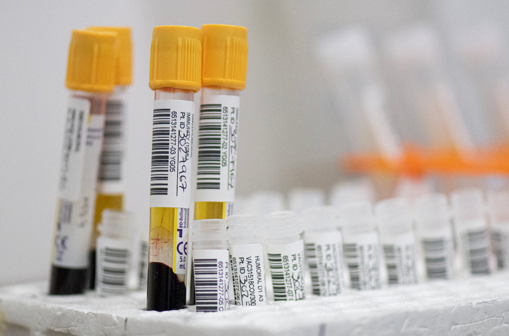 vacuna de Janssen y síndrome Guillain-Baré: advertencia de EEUU