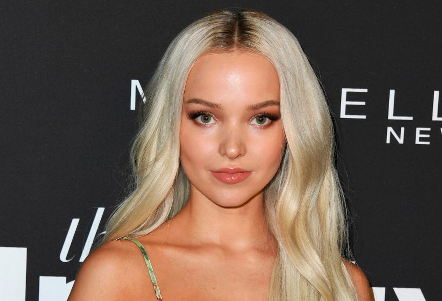 Lesión De Rodilla De Dove Cameron
