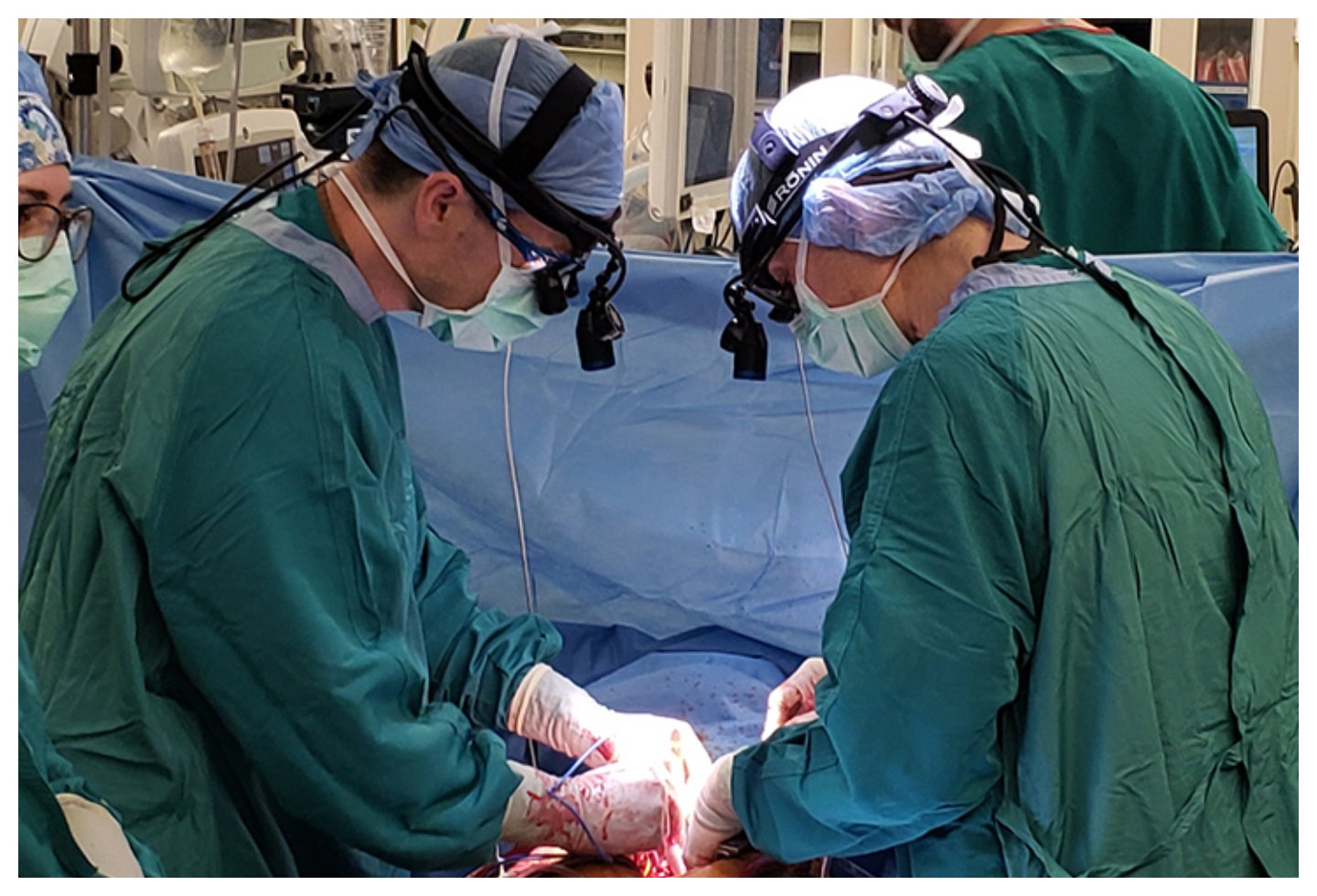 Reviven corazón muerto para ser trasplantado